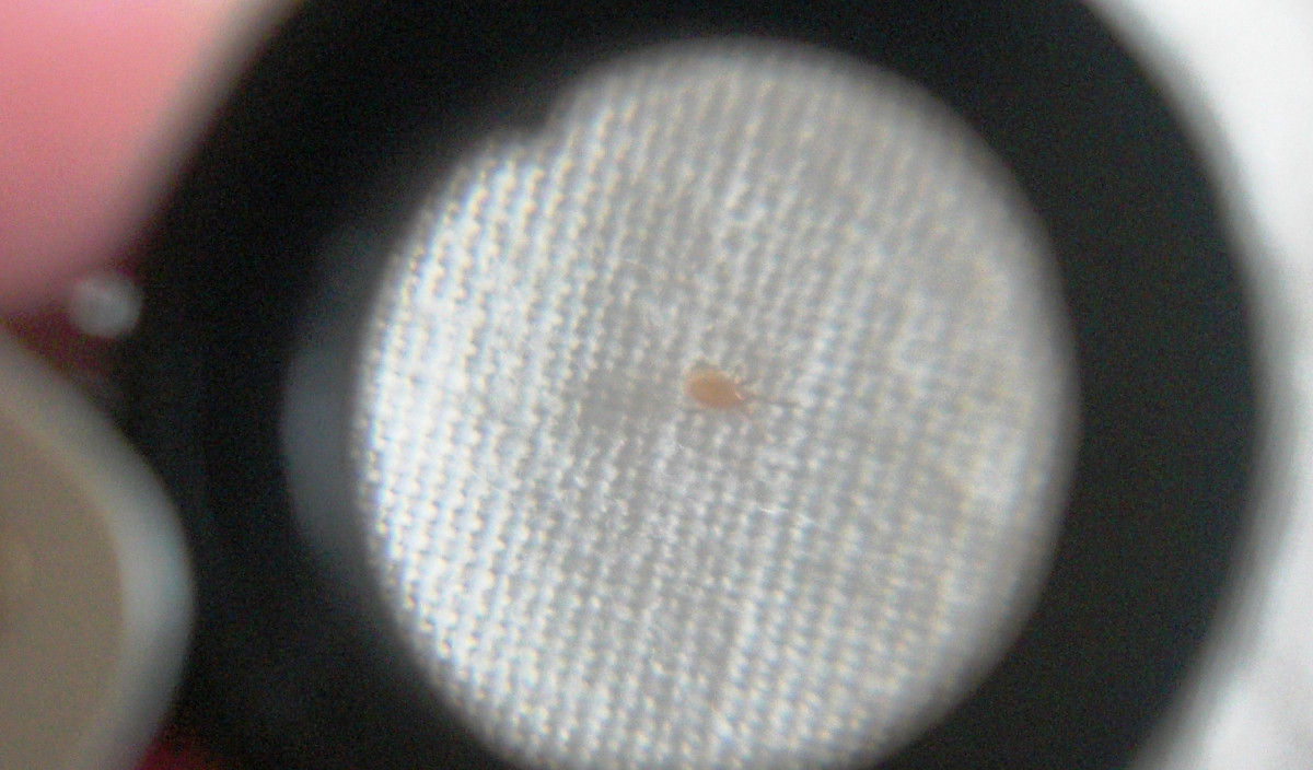 How to Control Red Poultry Chicken Mite | Kiwicare